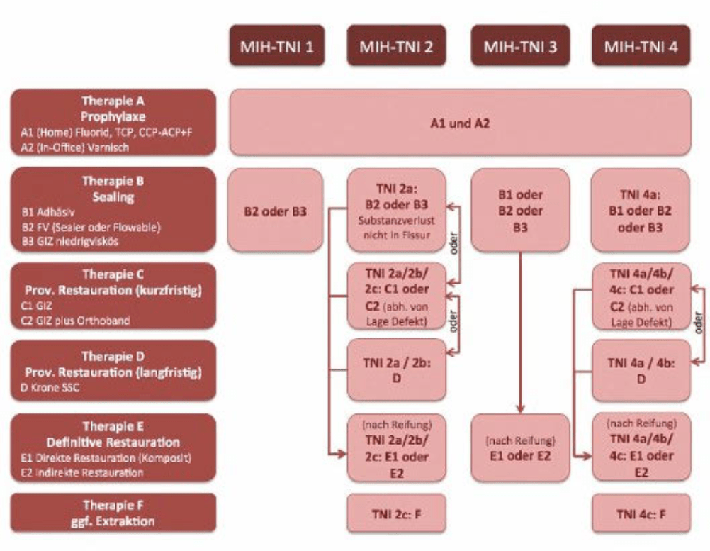Kreidezähne-Behandlung: Problemfall MIH - dentalmagazin.de